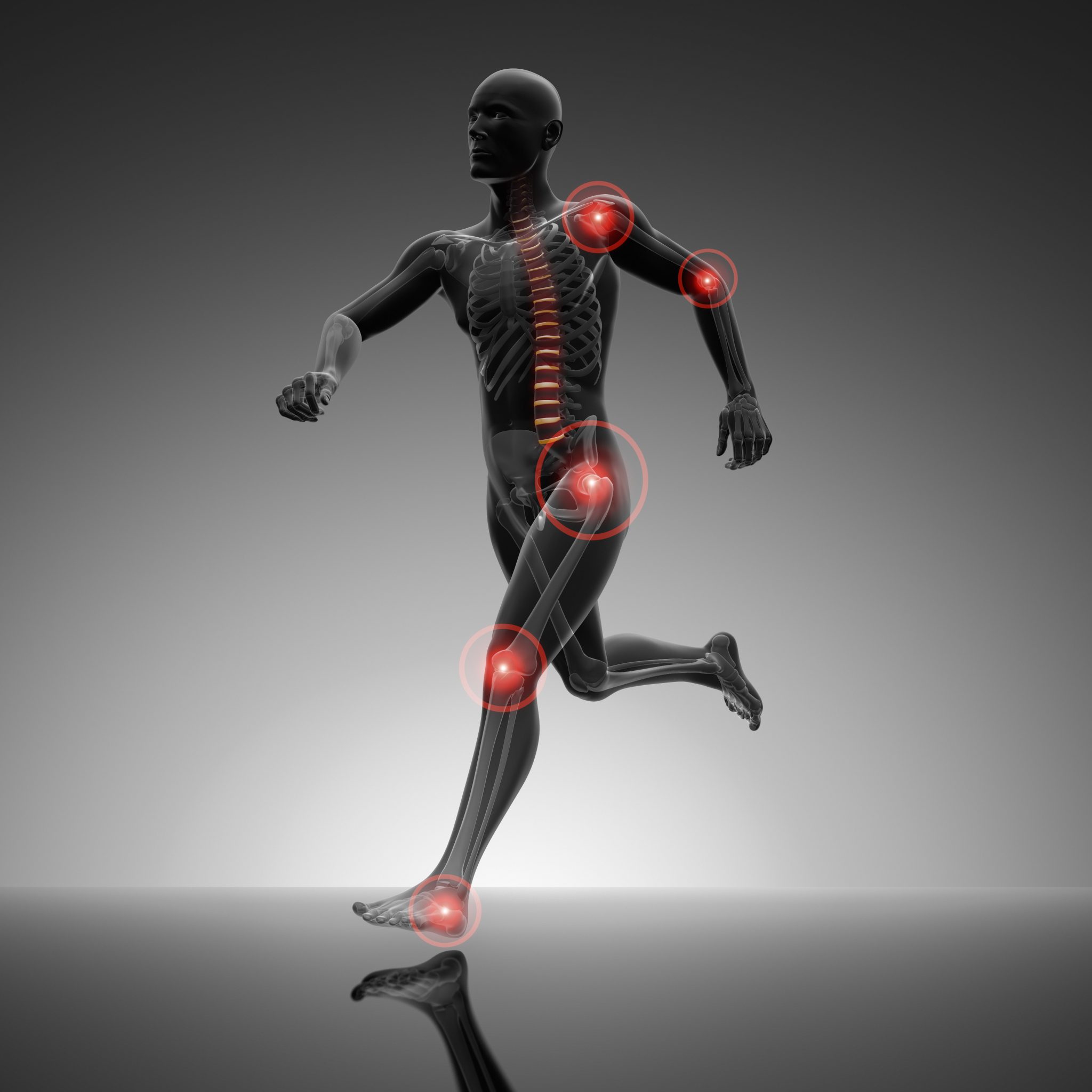 Knochenmarködem Behandlung Wien | Orthopäde Dr. Nepp